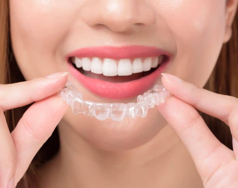 Invisalign® Cost in Texas | Affordable Clear Aligners at $3,999