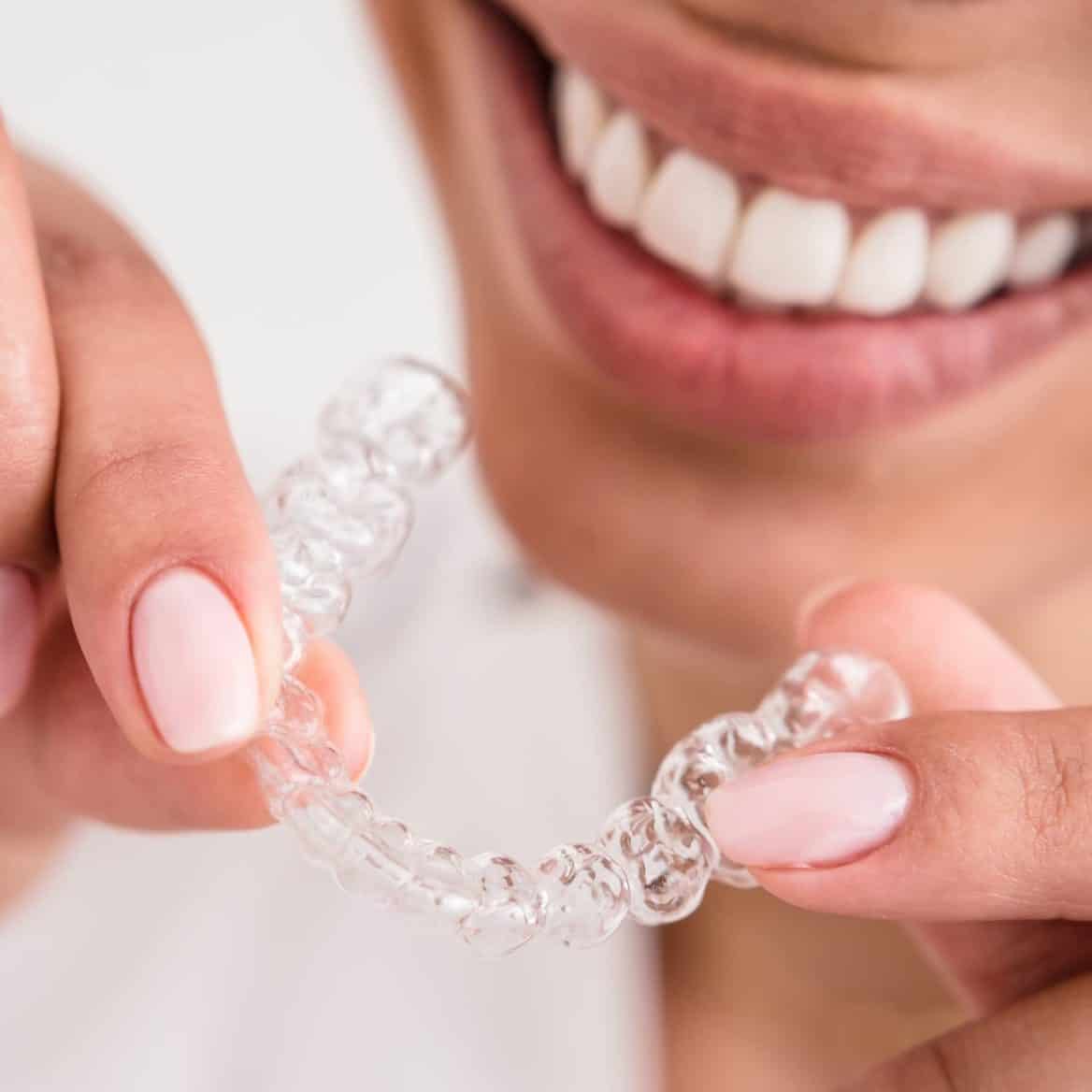 Invisalign And Holistic Orthodontics In Houston Austin Tx